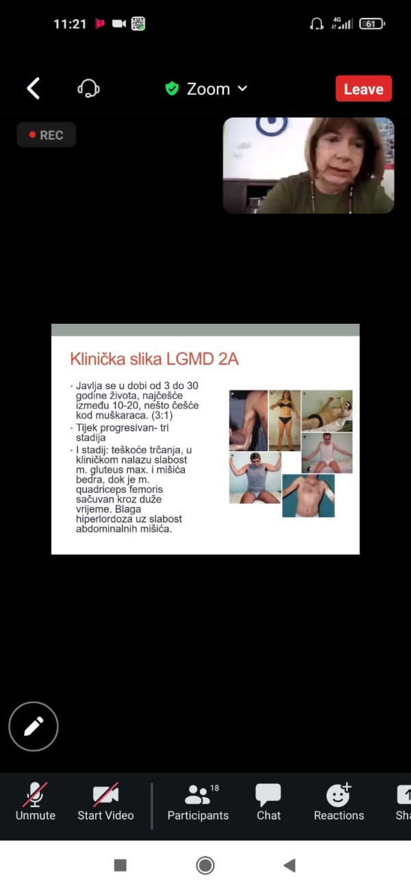 Medicinsko savjetovalište - Pojasne mišićne distrofije / Vijesti / Društvo distrofičara Zagreb - DDZ